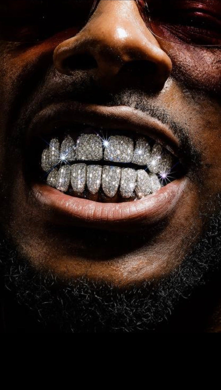 How Much Do Grillz Cost in 2026? Real Prices Explained – SGG
