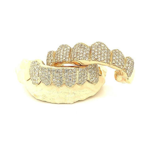 Gold Diamond Set Grillz made by Seattle Gold Grillz