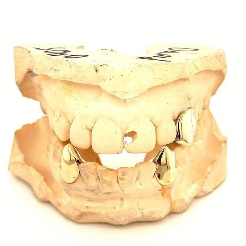 1 Top 2 Bottom Gold Grillz by Seattle Gold Grills – Seattle Gold Grillz