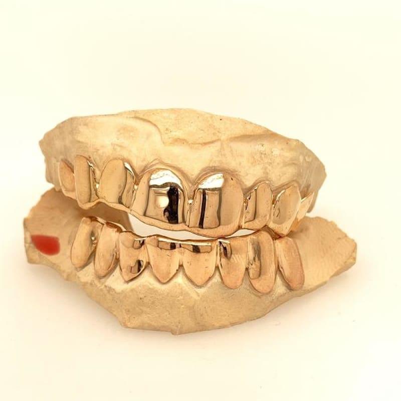 16pc Rose Gold Grillz custom made by Seattle Gold Grillz