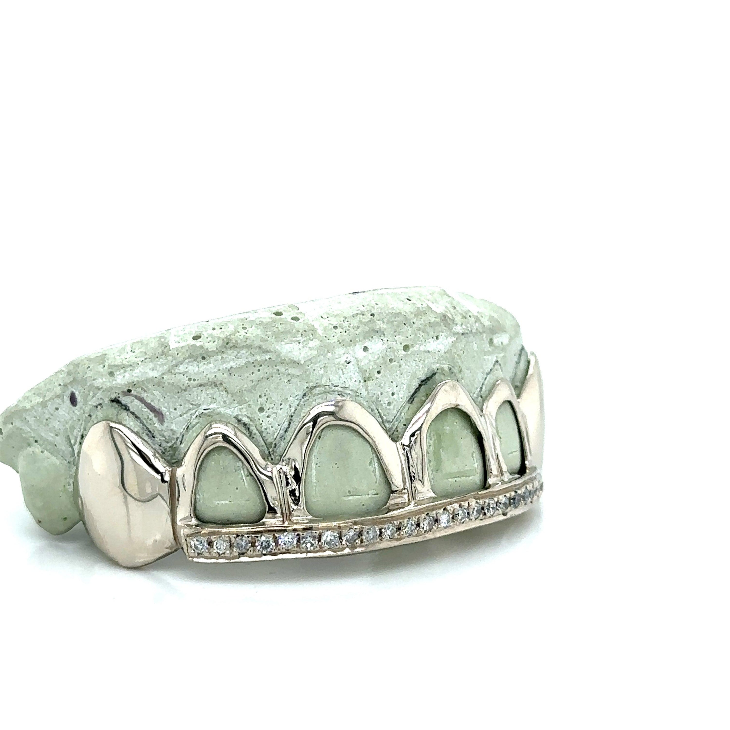 12pc Gold Open Face Diamond Grillz | Seattle Gold Grillz