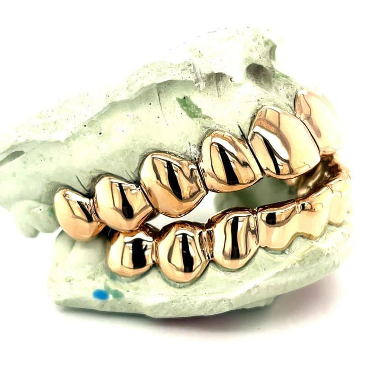 20pc Gold Perm Cut Grillz hand made by Seattle Gold Grillz