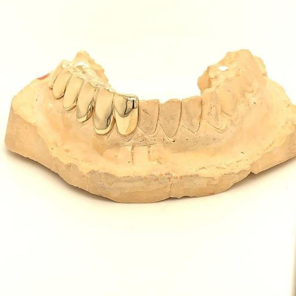 6pc Gold Right Side Grillz made by Seattle Gold Grillz