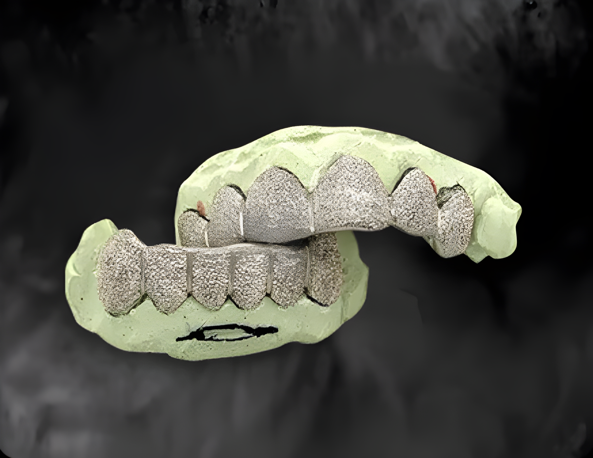 Custom grillz and custom jewelry by Seattle Gold Grills! – Seattle Gold ...