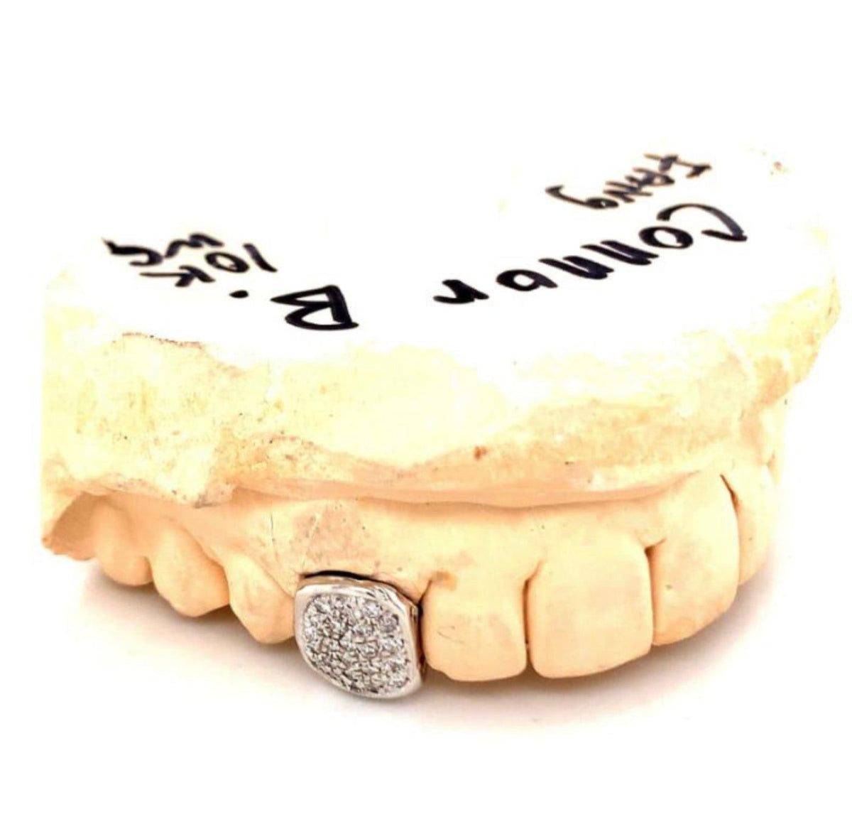 Single Diamond Top Fang Grillz – Seattle Gold Grillz