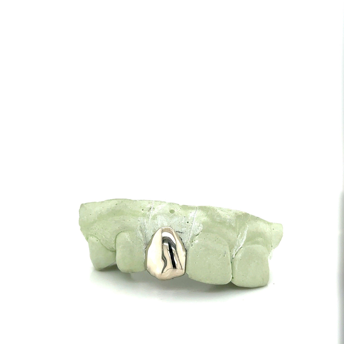 White Gold Right Side Incisor Top Tooth – Seattle Gold Grillz