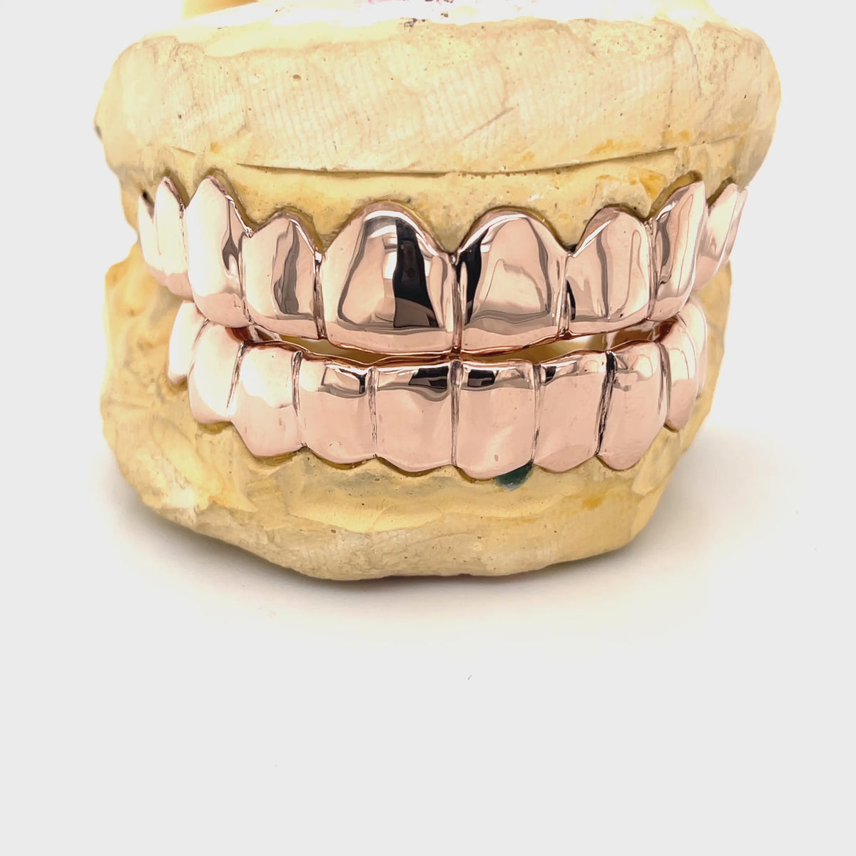 20pc Rose Gold Grillz custom made by Seattle Gold Grills – Seattle Gold ...