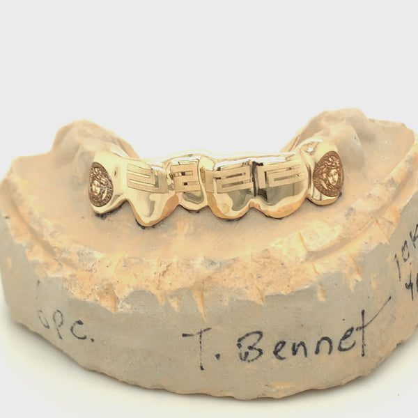 6pc Gold Versace Greek Key Bottom Grillz – Seattle Gold Grillz